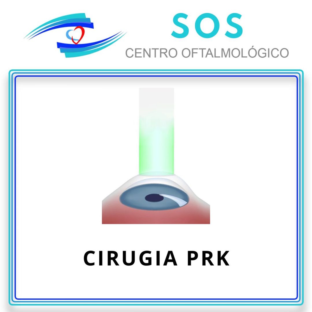 Cirugía PRK – Centro Oftalmológico SOS